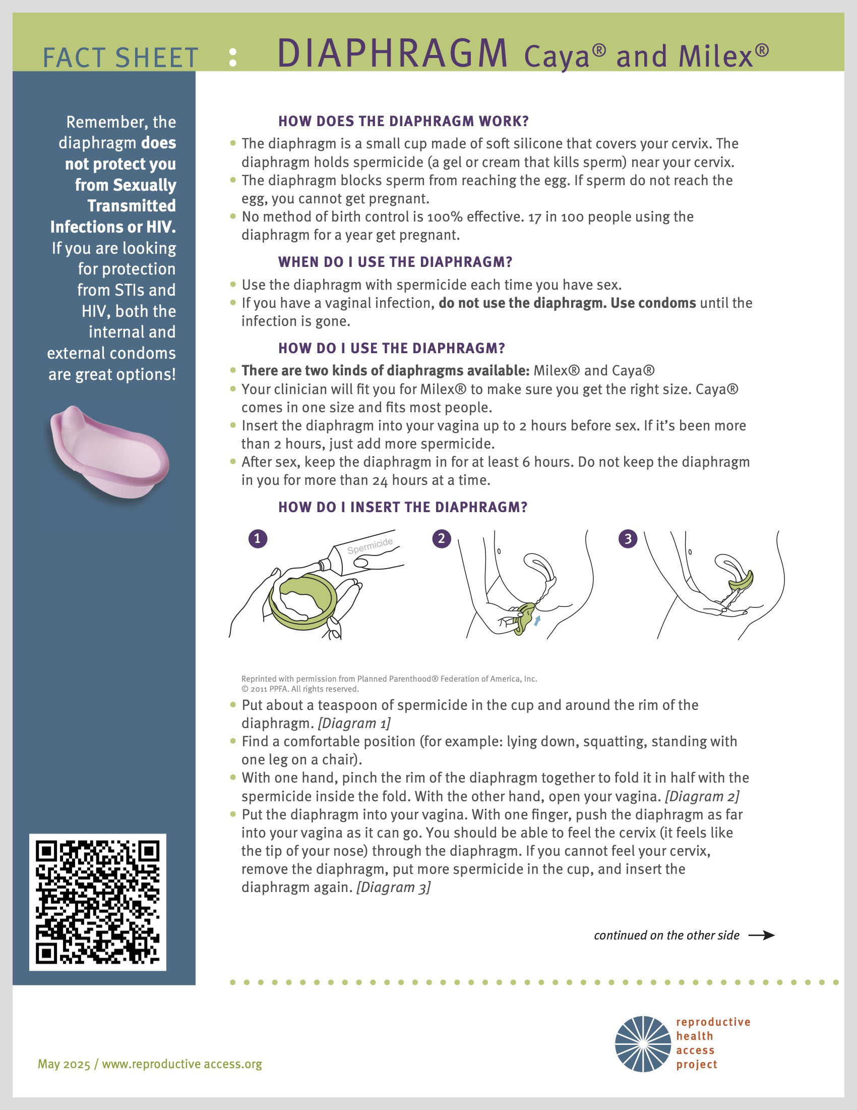 Reproductive Health Access Project | Diaphragm User Guide